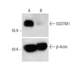 SQSTM1/p62 CRISPR基因敲除和激活产品 (h) | SCBT - Santa Cruz Biotechnology