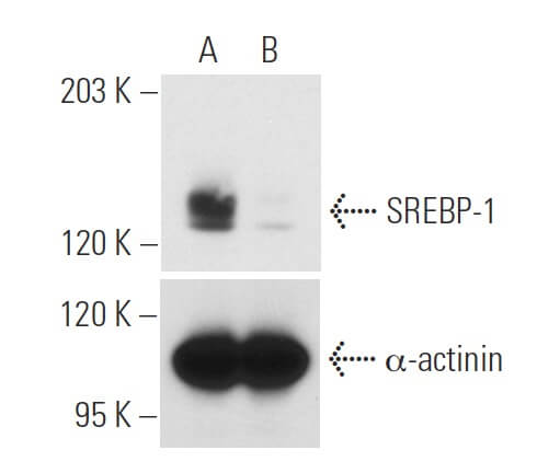 SREBP-1 siRNA (h), shRNA and Lentiviral Particle Gene Silencers | SCBT ...