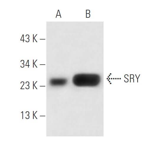 SRY抗体 (SRY-15) | SCBT - Santa Cruz Biotechnology