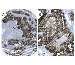 SSEA-1 Antibody (480) - Immunohistochemistry - Image 37561