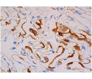 SSEA-1 Antibody (480) - Immunohistochemistry - Image 358498