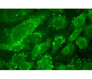 SSEA-4 Antibody (813-70) - Immunofluorescence - Image 391781