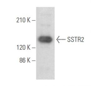 SSTR2 Antibody (A-8) - Western Blotting - Image 355569