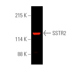 SSTR2 Antibody (A-8) - Western Blotting - Image 389777