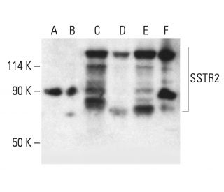 SSTR2 Antibody (A-8) - Western Blotting - Image 402315