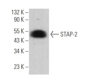 STAP-2 Antibody (E-4) | SCBT - Santa Cruz Biotechnology