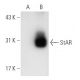Anti-StAR Antibody (D-2) | SCBT - Santa Cruz Biotechnology