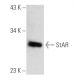 Anti-StAR Antibody (D-2) | SCBT - Santa Cruz Biotechnology