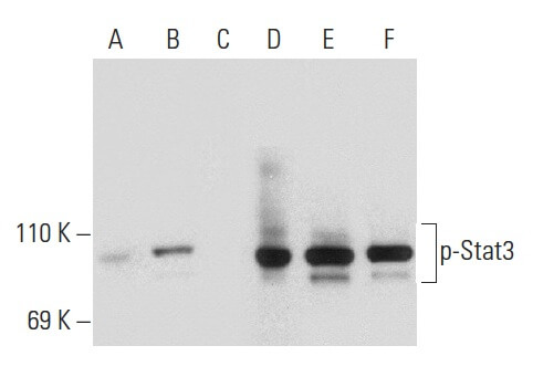 Anti-Stat3 Antibody (F-2) | SCBT - Santa Cruz Biotechnology