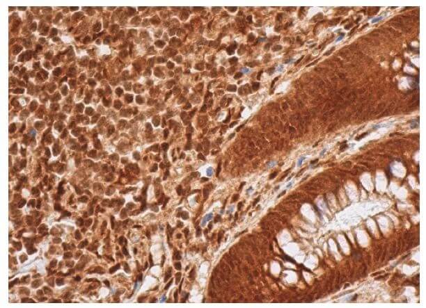 Stat6 Antibody (D-1) | SCBT - Santa Cruz Biotechnology