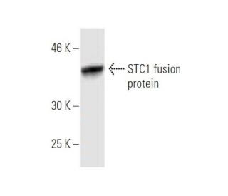 STC1 Antibody (1A3) - Western Blotting - Image 348857