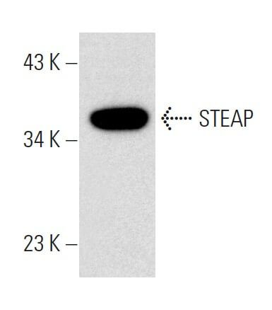 STEAP Antibody (H-105) | SCBT - Santa Cruz Biotechnology