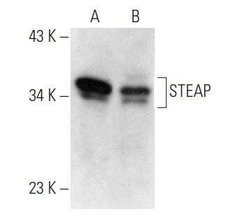 STEAP Antibody (H-6) | SCBT - Santa Cruz Biotechnology