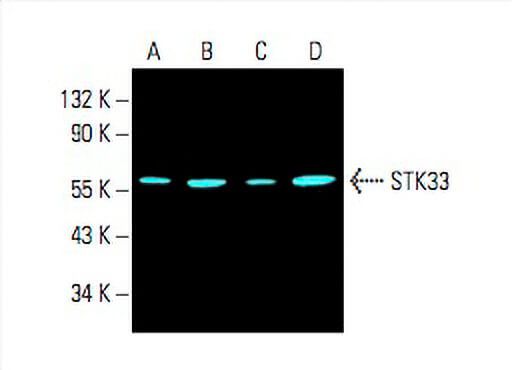 STK33 Antibody (G-11) | SCBT - Santa Cruz Biotechnology