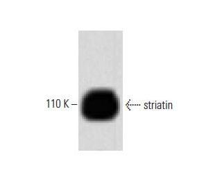 Anti-striatin Antibody (6) | SCBT - Santa Cruz Biotechnology