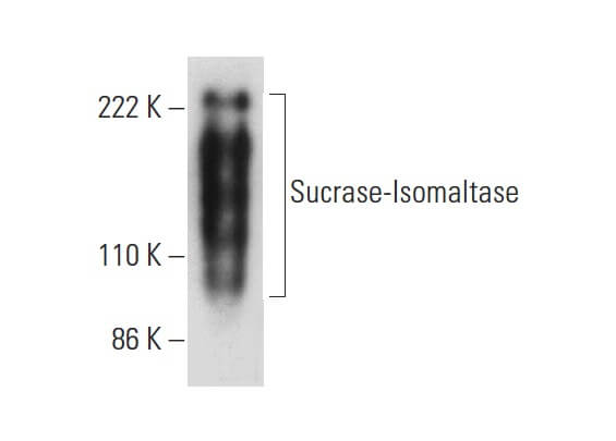 Anti-Sucrase-Isomaltase Antibody (A-12) | SCBT - Santa Cruz Biotechnology