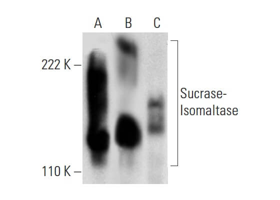 Anti-Sucrase-Isomaltase Antibody (A-12) | SCBT - Santa Cruz Biotechnology