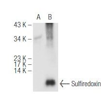 Sulfiredoxin Antibody (E-2) | SCBT - Santa Cruz Biotechnology