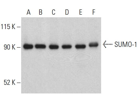 Anti-SUMO-1 Antibody (D-11) | SCBT - Santa Cruz Biotechnology