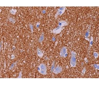 SV2A Antibody (E-8) - Immunohistochemistry - Image 374097