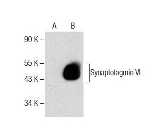 Anti-Synaptotagmin VI Antibody (A-12) | SCBT - Santa Cruz Biotechnology