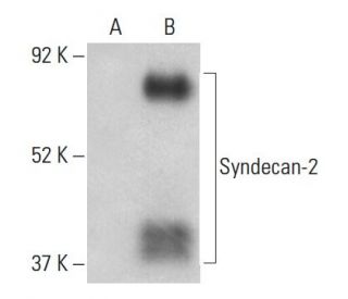 Syndecan-2 Antibody (H-7) - Western Blotting - Image 398516