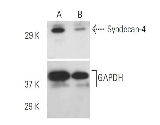 SYND4/SDC4/Syndecan-4siRNA(h)、shRNAとレンチウイルス粒子遺伝子サイレンサー | SCBT - Santa ...