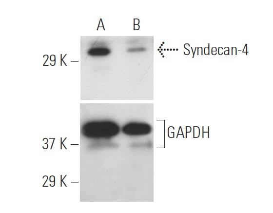 SYND4/SDC4/Syndecan-4 siRNA (h), shRNA and Lentiviral Particle Gene ...