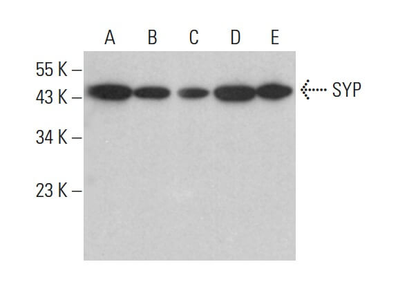 SYP/Synaptophysin Antibody (A-9) | SCBT - Santa Cruz Biotechnology