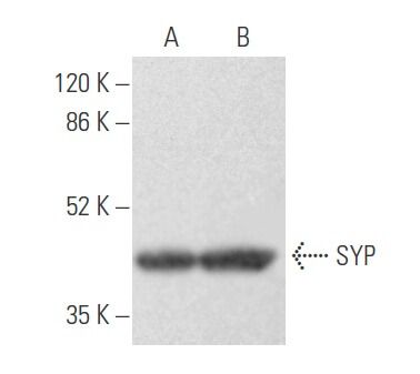 SYP/Synaptophysin 항체 (C-12) | SCBT - Santa Cruz Biotechnology