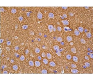 Anti-SYP/Synaptophysin Antibody (D-4) | SCBT - Santa Cruz Biotechnology