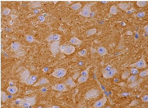 Anti-SYP/Synaptophysin Antibody (D-4) | SCBT - Santa Cruz Biotechnology