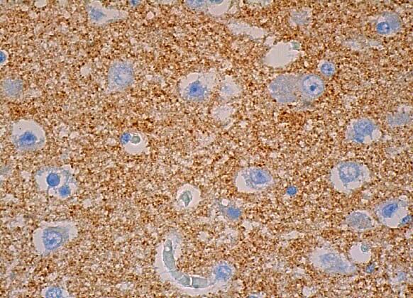 Anti-SYP/Synaptophysin Antibody (D-4) | SCBT - Santa Cruz Biotechnology