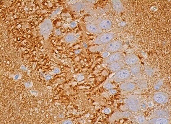 Anti-SYP/Synaptophysin Antibody (D-4) | SCBT - Santa Cruz Biotechnology