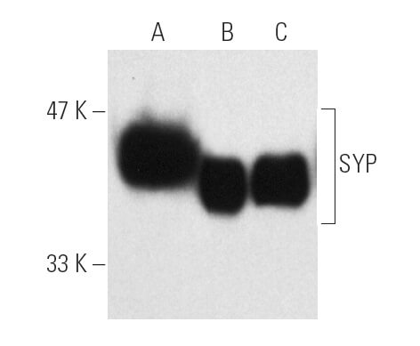 Anti-SYP/Synaptophysin Antibody (D-4) | SCBT - Santa Cruz Biotechnology