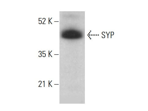 Anti-SYP/Synaptophysin Antibody (D-4) | SCBT - Santa Cruz Biotechnology