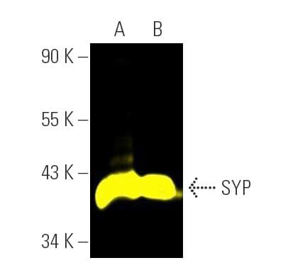 Anti-SYP/Synaptophysin Antibody (D-4) | SCBT - Santa Cruz Biotechnology