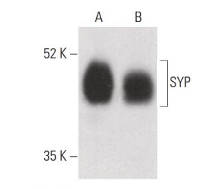 Anti-SYP/Synaptophysin Antibody (D-4) | SCBT - Santa Cruz Biotechnology