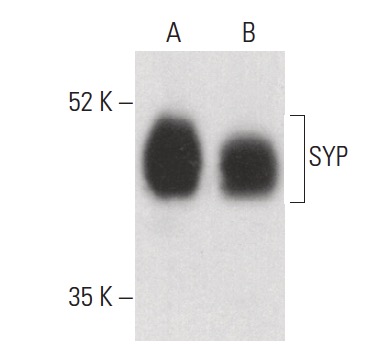 Anti-SYP/Synaptophysin Antibody (D-4) | SCBT - Santa Cruz Biotechnology