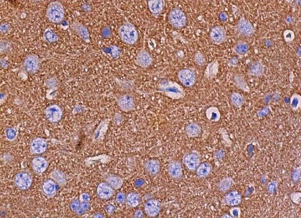 Anti-SYP/Synaptophysin Antibody (H-8) | SCBT - Santa Cruz Biotechnology