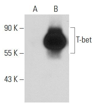 T-bet/TBX21 Antibody (39D) | SCBT - Santa Cruz Biotechnology