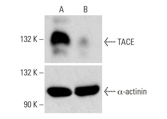 Anti-TACE/ADAM17 Antibody (B-6) | SCBT - Santa Cruz Biotechnology