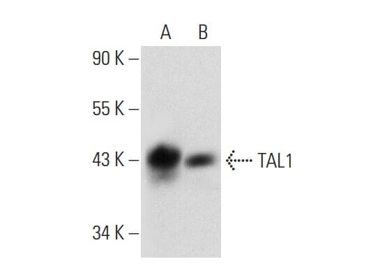 TAL1 Antibody (E-4) | SCBT - Santa Cruz Biotechnology
