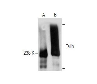 Talin Antibody (TA205) | SCBT - Santa Cruz Biotechnology