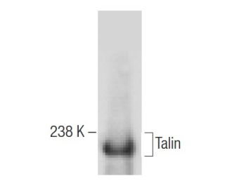 Talin Antibody (TLN01 [TA205]) - Western Blotting - Image 285998