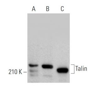 Talin Antibody (TLN01 [TA205]) - Western Blotting - Image 379536