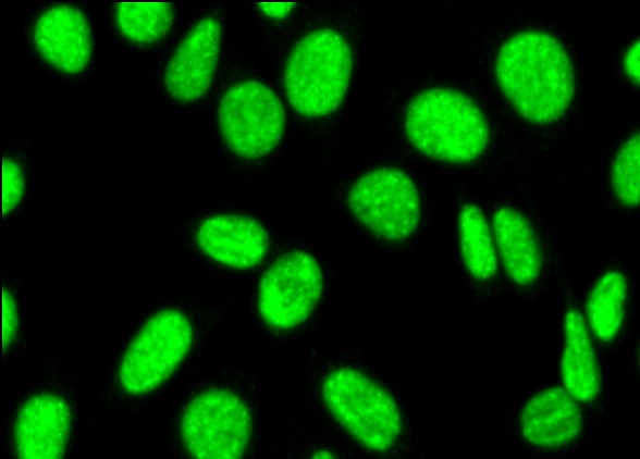 Anti-TAP Antibody (53H8) | SCBT - Santa Cruz Biotechnology