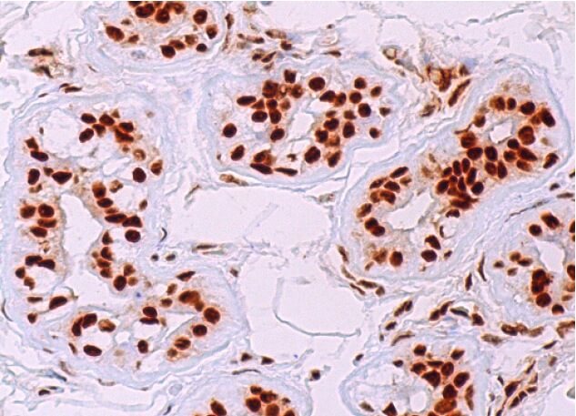 Anti-TAP Antibody (53H8) | SCBT - Santa Cruz Biotechnology
