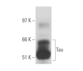 Tau Antibody (TAU-5) - Western Blotting - Image 17568