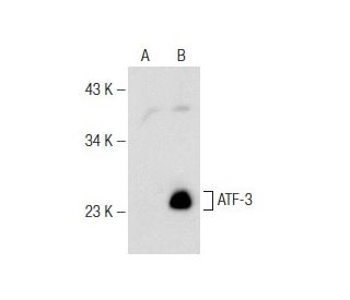 Taurolidine | CAS 19388-87-5 | SCBT - Santa Cruz Biotechnology